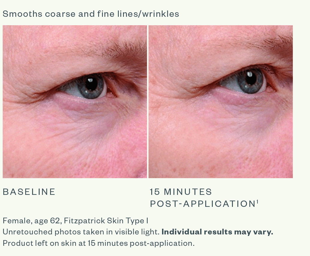 SkinMedica Instant Bright Eye Cream 0.5 fl. oz. Dermstore